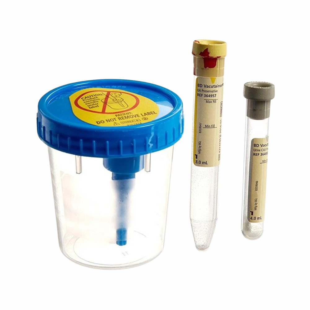 Urine Collection Cup & Tiger Tube (10 count) – Modus