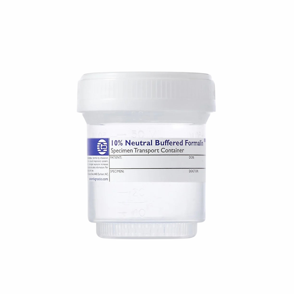 Formalin Containers (5 pack) – Modus